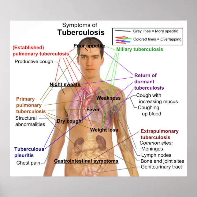 Symptomdiagramm der Tuberkulose beim Menschen Poster | Zazzle.de